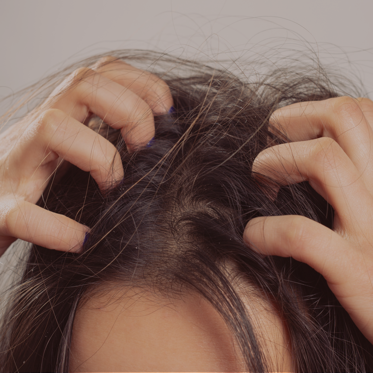 Hair Concerns – Medihair